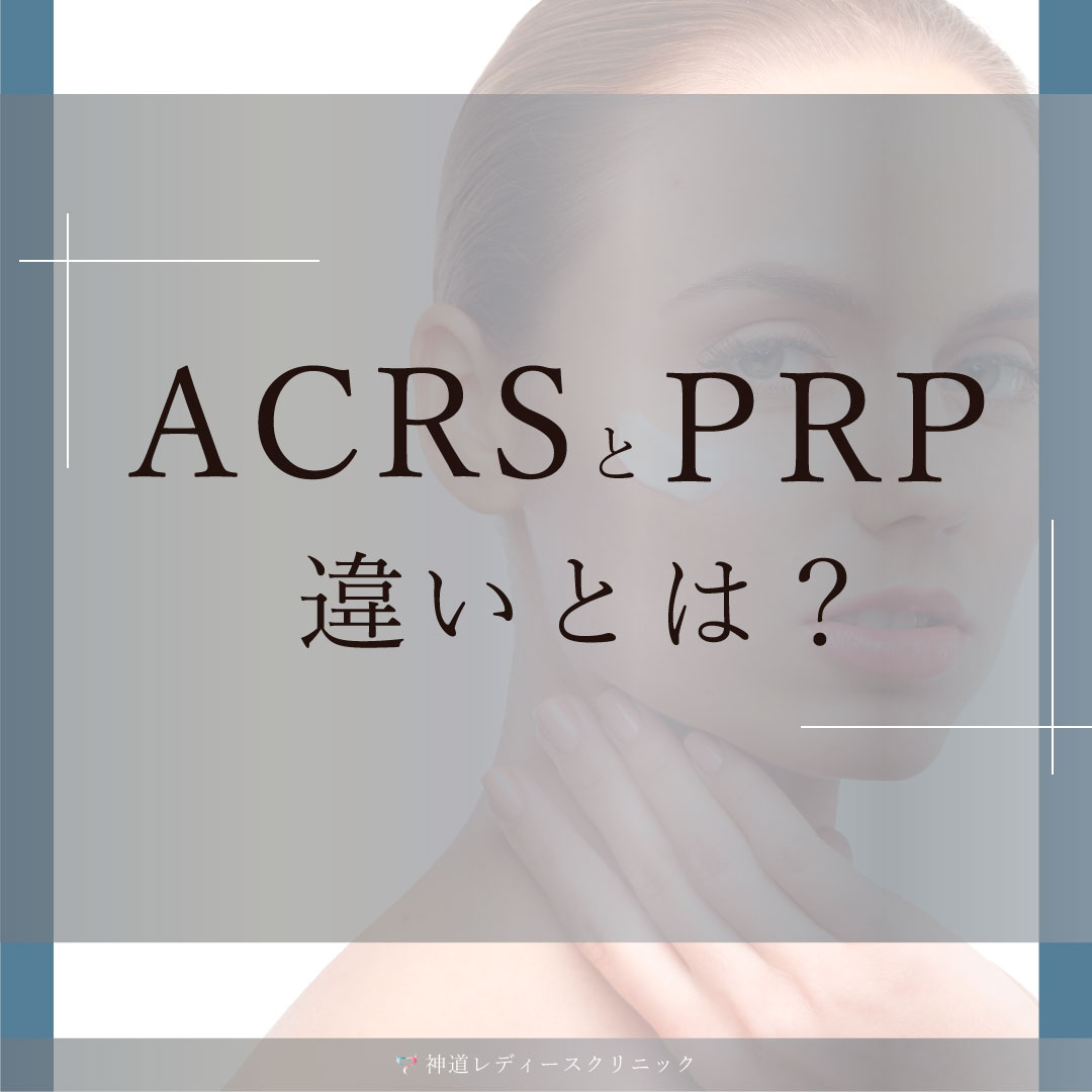 ACRS治療症例モデル様募集!! | 大阪府門真市・守口市の神道レディースクリニック